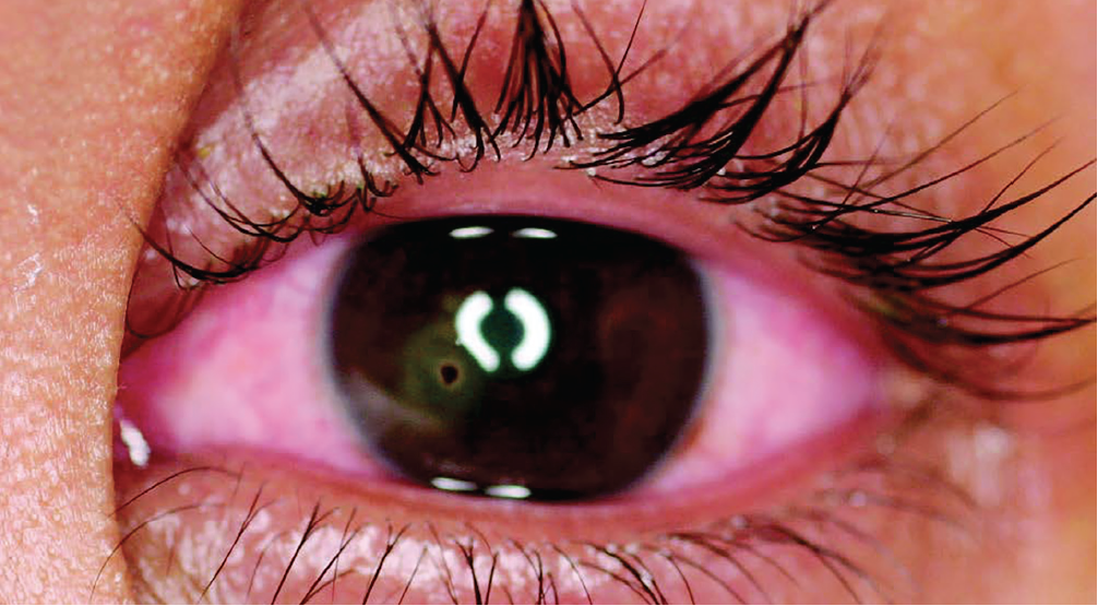 A Collection of Foreign Body Ingestions and Insertions | Consultant360